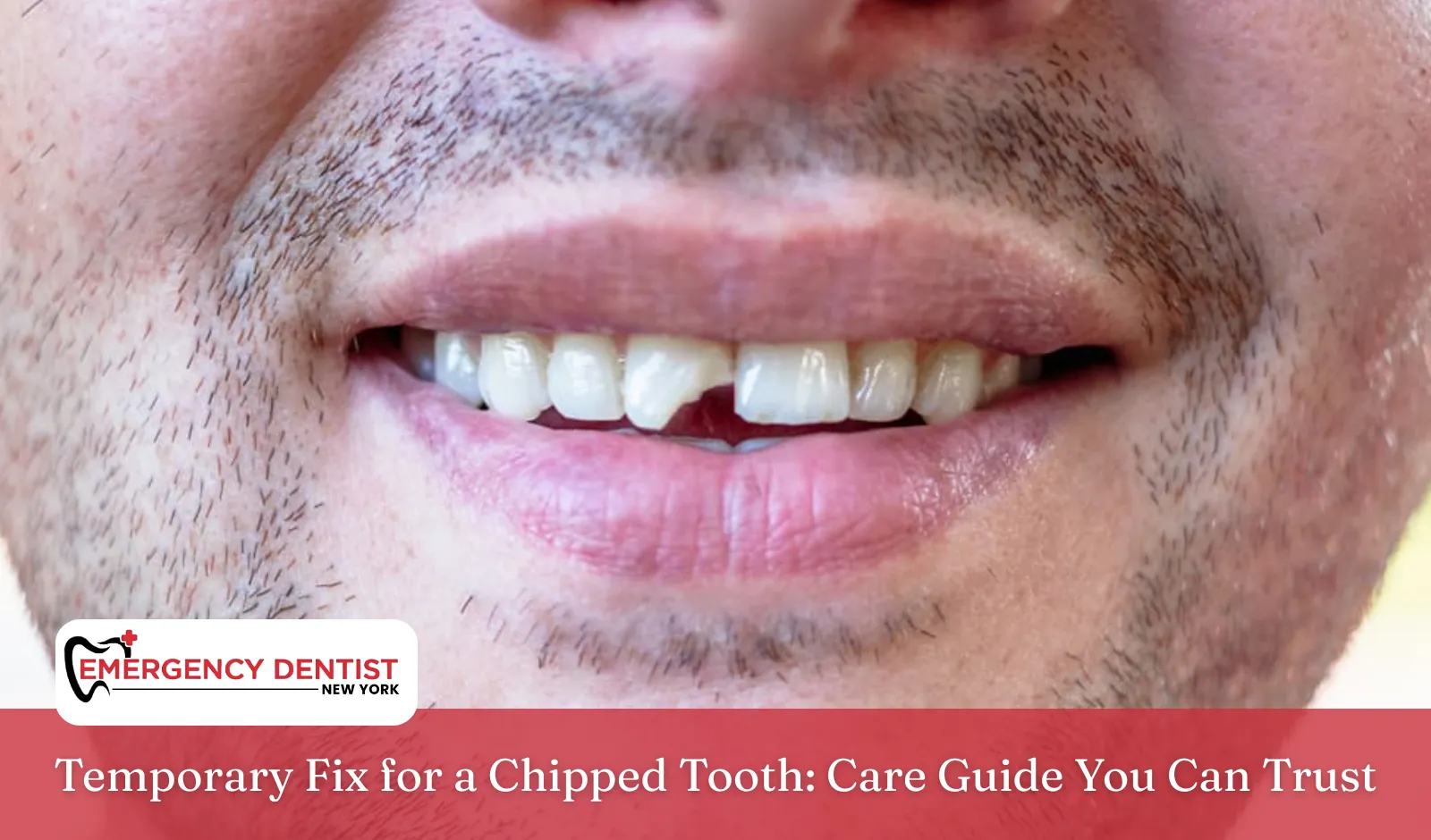 Temporary Fix for a Chipped Tooth: Care Guide You Can Trust